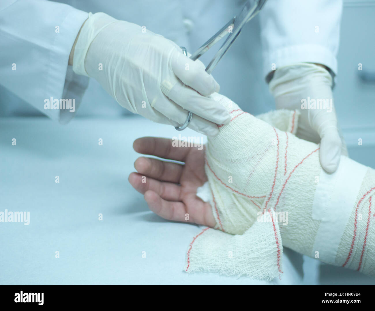 Doctor applying a plaster cast and bandages to patient forearm and ...