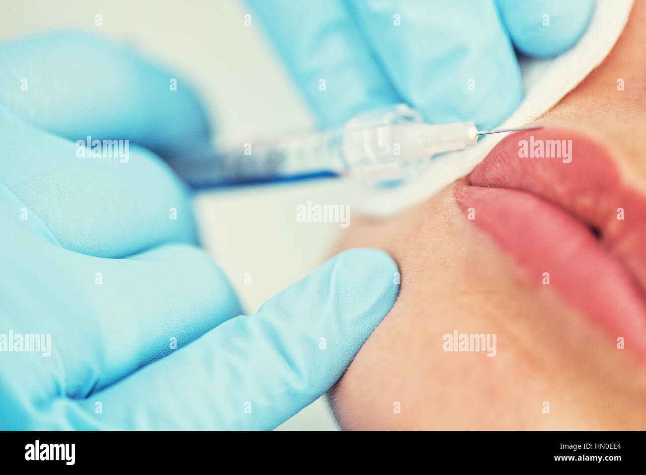 woman gets injection in her lips Stock Photo - Alamy