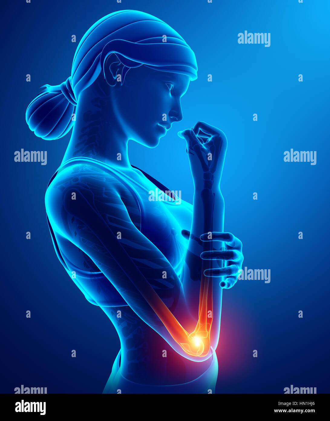 3d Illustration of Women Feeling the Elbow Pain Stock Photo - Alamy