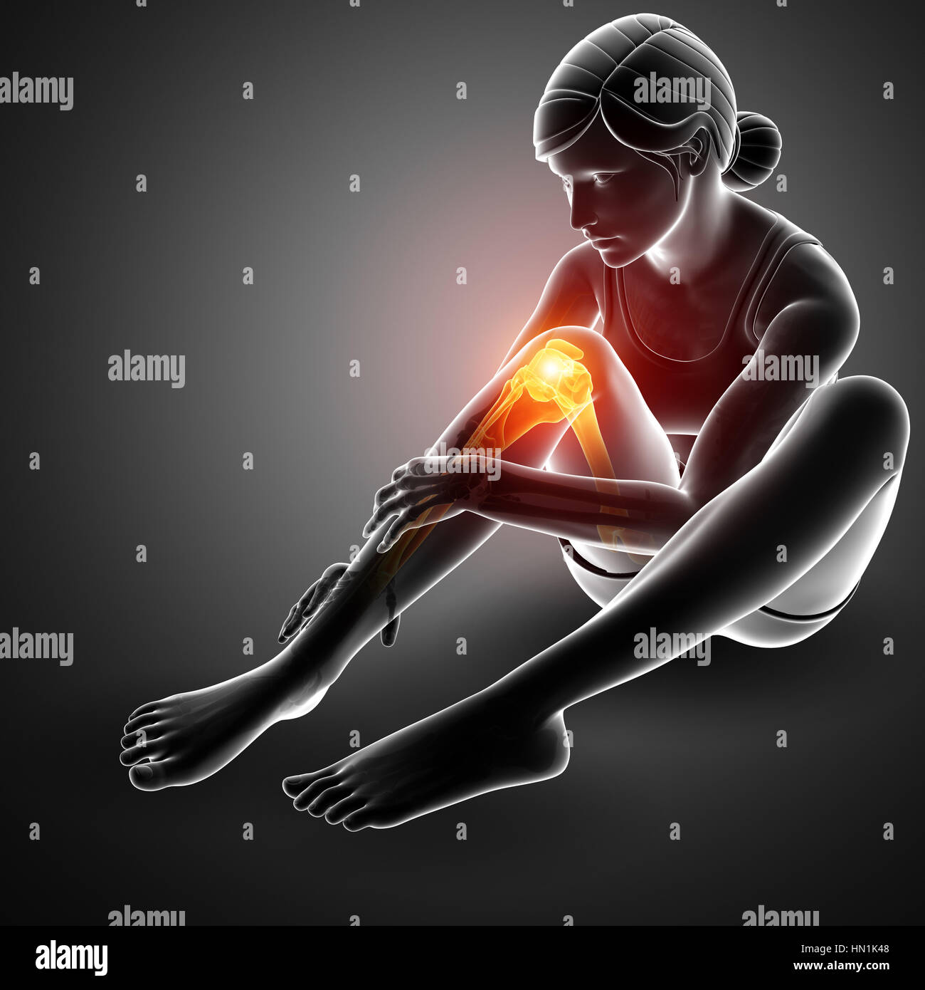 3d illustration of Female foot with ankle pain Stock Photo - Alamy
