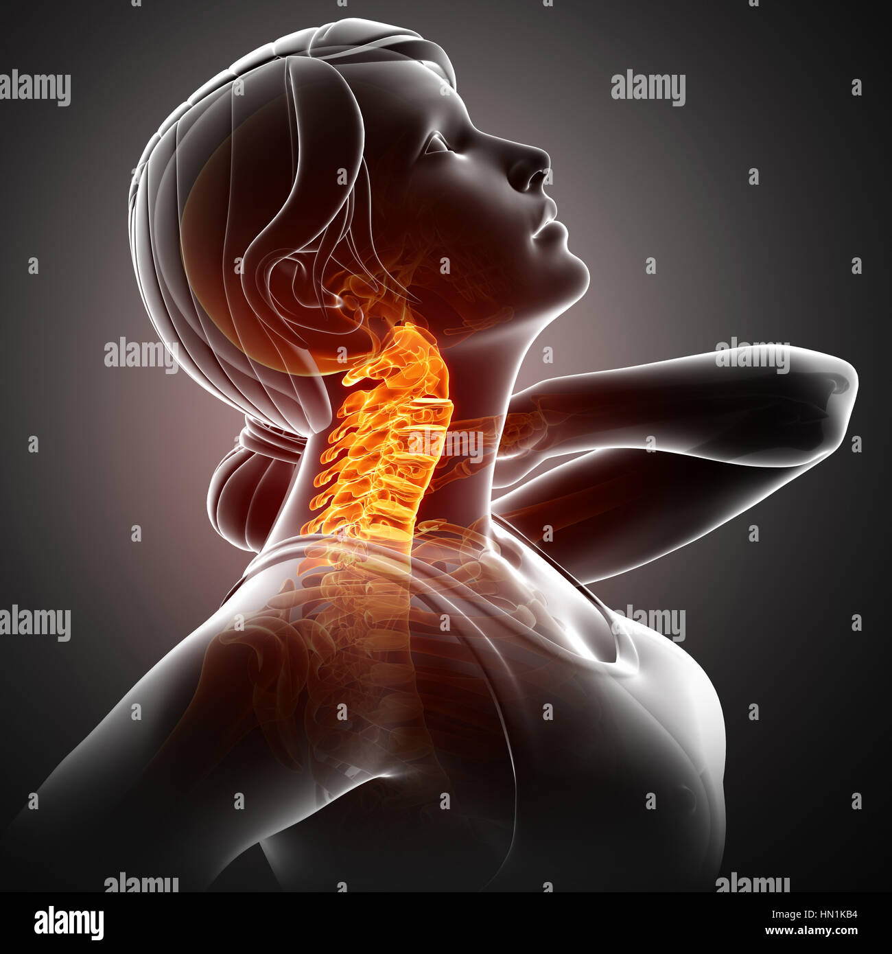 3d Illustration of Women Feeling the Neck Pain Stock Photo - Alamy