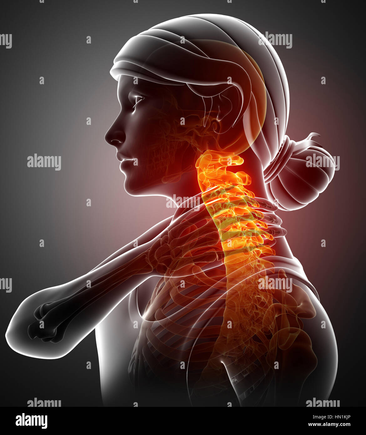 3d Illustration of Women Feeling the Neck Pain Stock Photo - Alamy