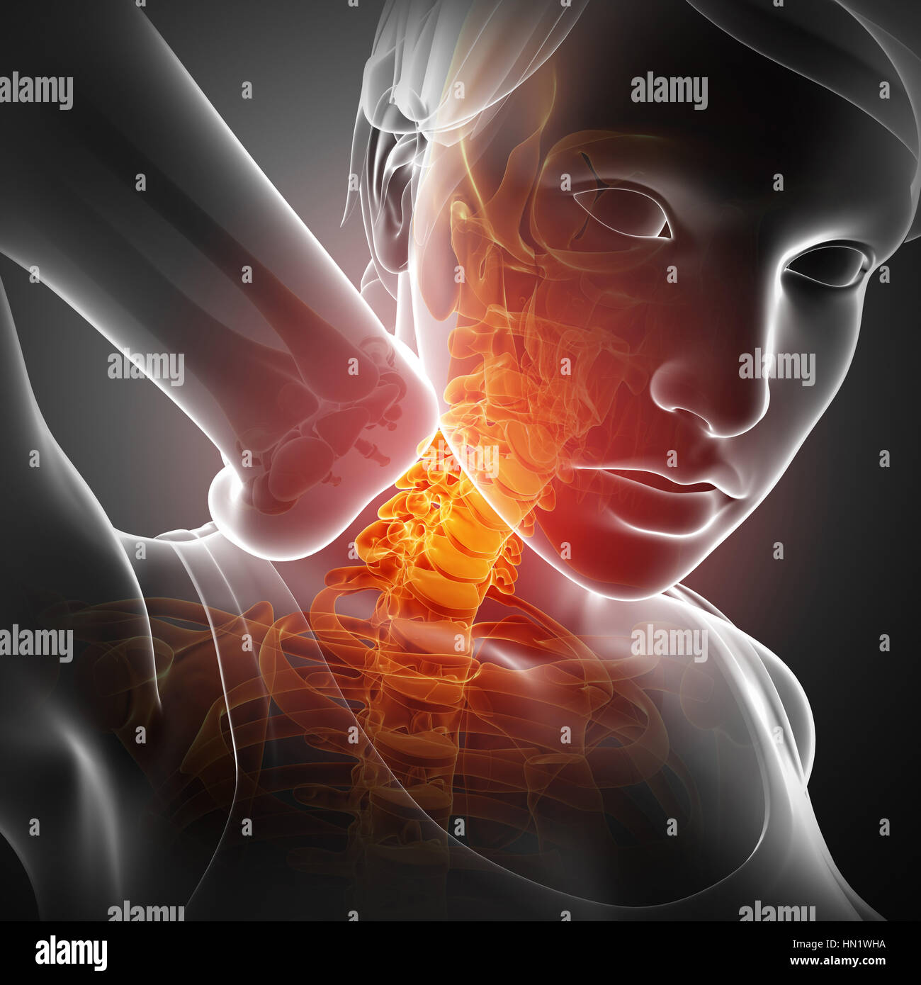 3d Illustration of Women Feeling the Neck Pain Stock Photo - Alamy