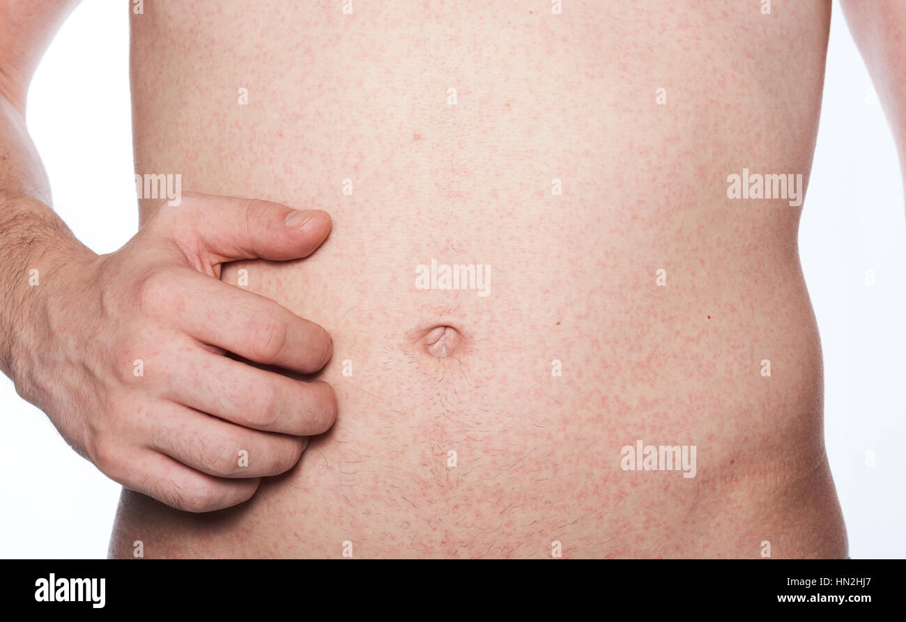 Belly spot hi-res stock photography and images - Alamy