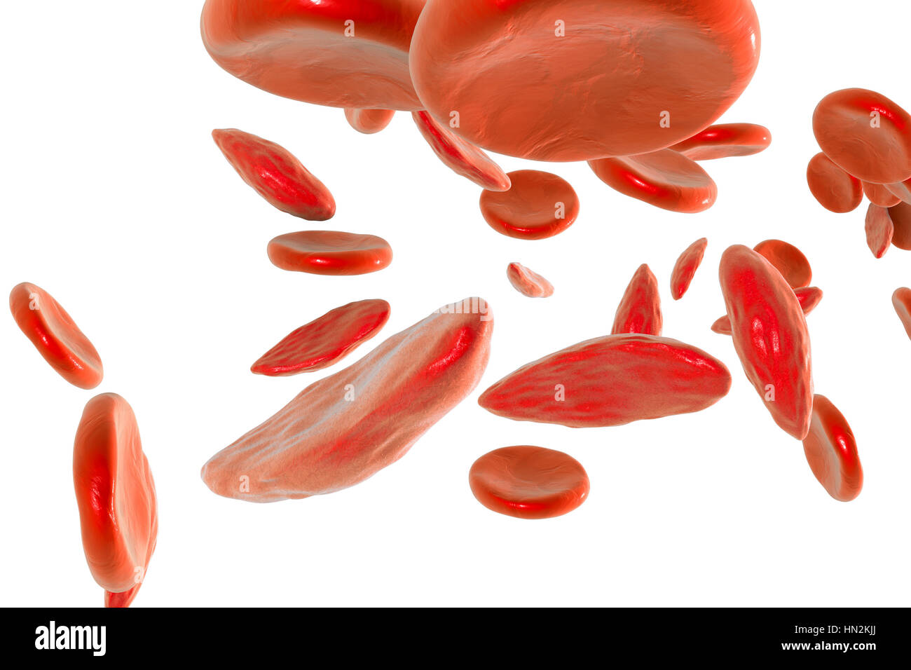 Normal red blood cell and a sickle cell hi-res stock photography and ...