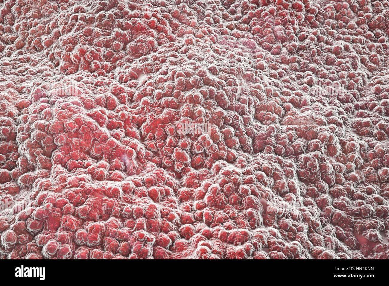 Normal stomach lining hi-res stock photography and images - Alamy