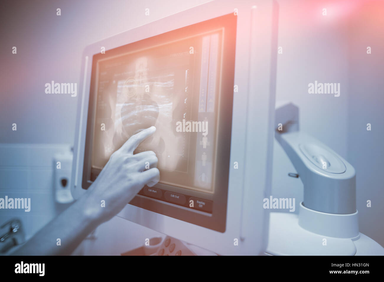 Xray of midsection of a human body against nurse pointing at ultrasonic ...