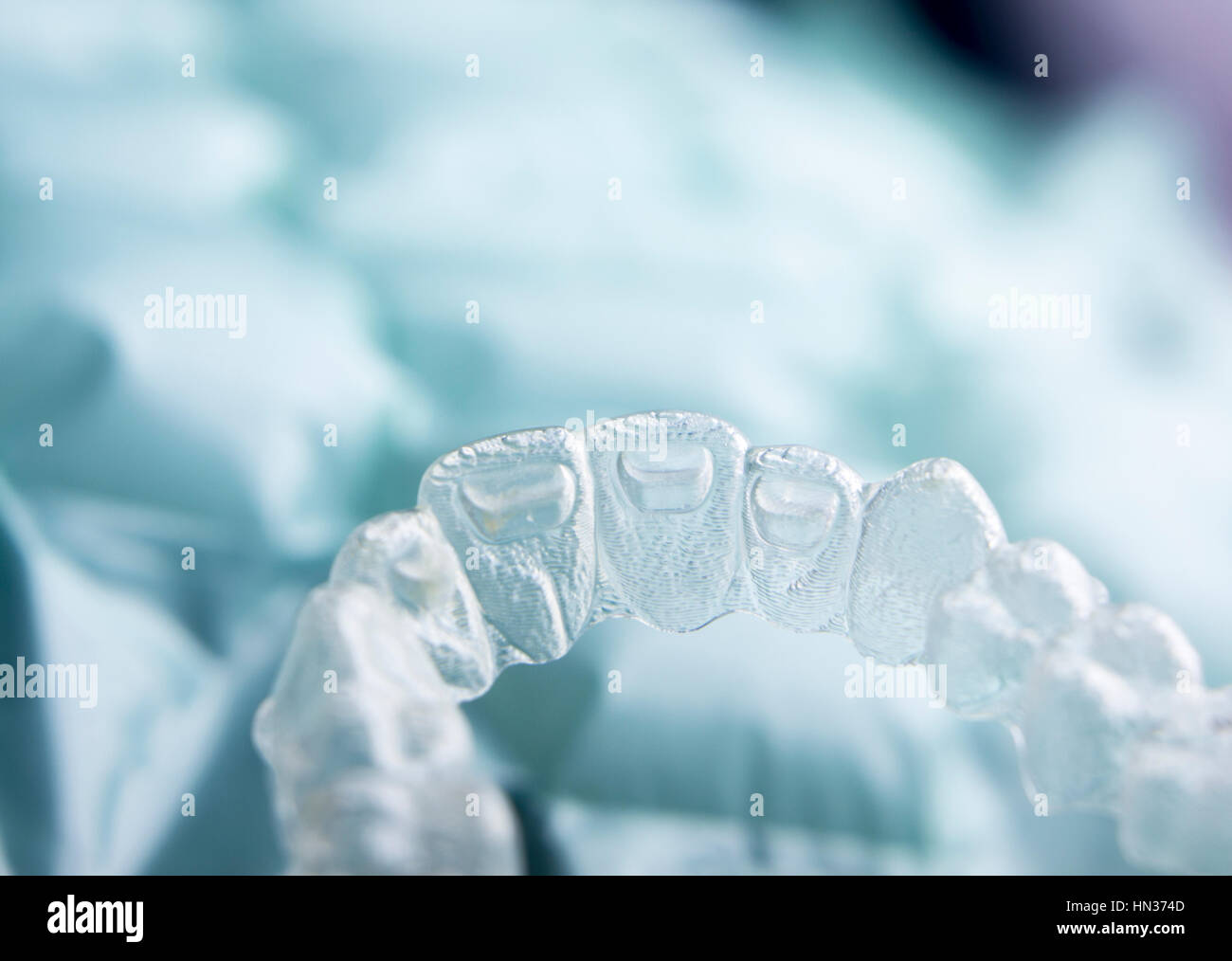 Invisible orthodontics cosmetic brackets tooth aligners plastic braces ...