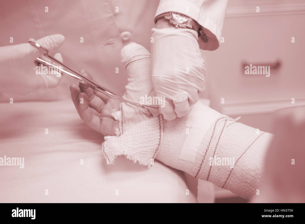 Doctor removing a plaster cast and bandages to patient forearm and ...