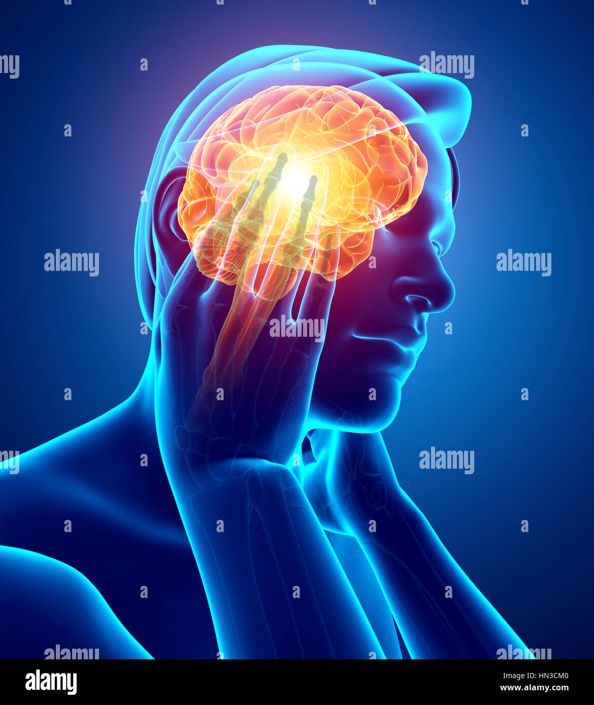 3d Illustration of Male Feeling Headache Stock Photo - Alamy