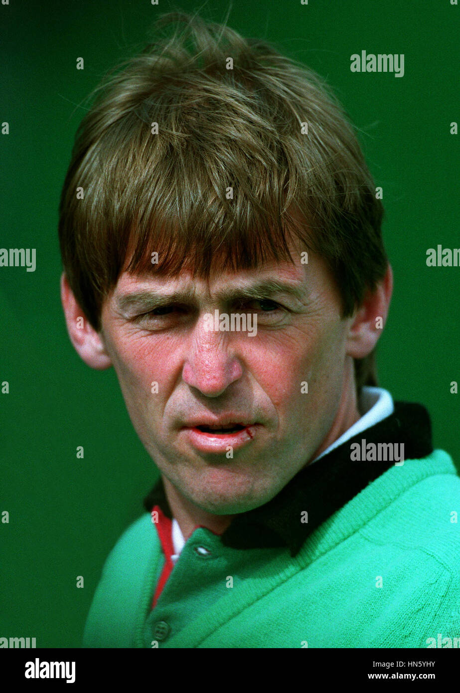 Kenny dalglish blackburn hi-res stock photography and images - Alamy