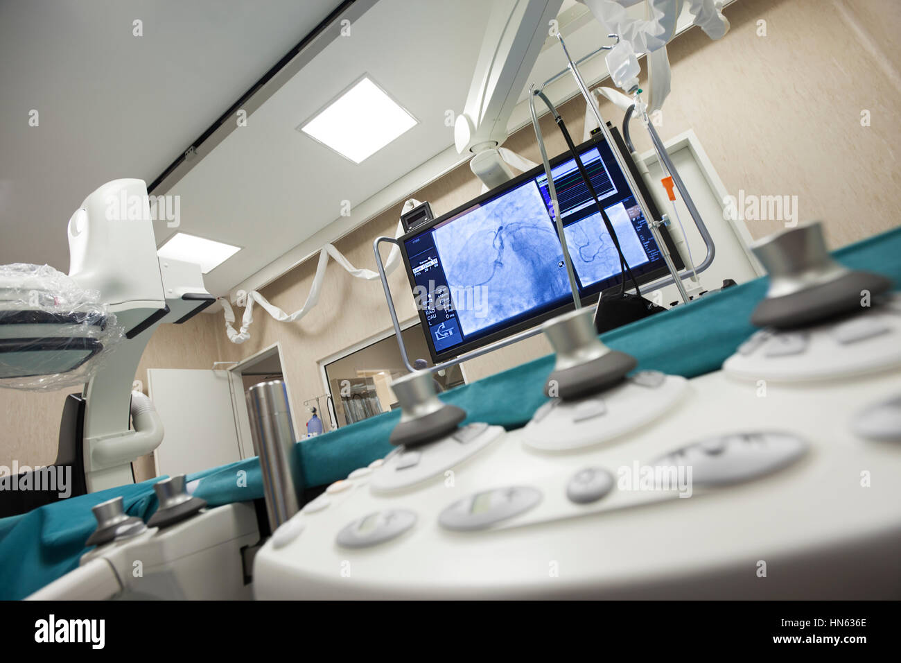 A modern hospital heart surgery room with monitor and scanner Stock ...
