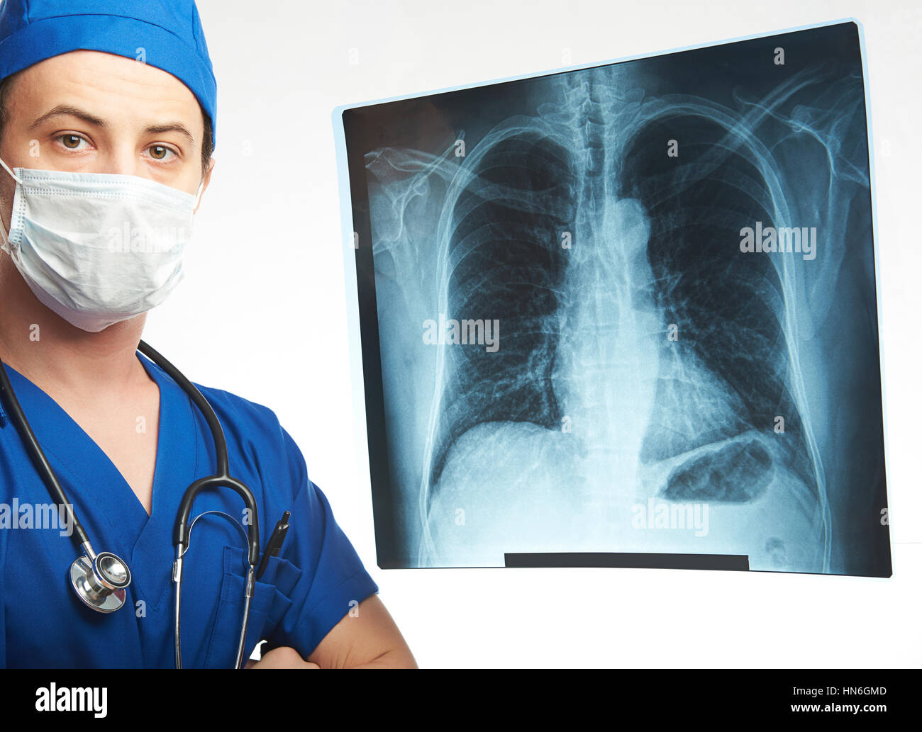 portrait of doctor with x-ray photo isolated on white Stock Photo - Alamy