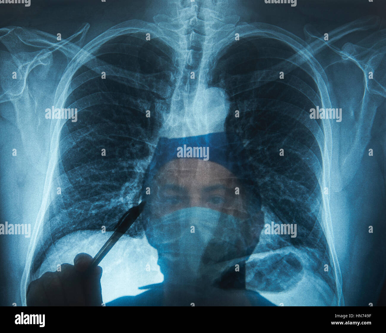 radiologist checking x-ray image before operation Stock Photo - Alamy