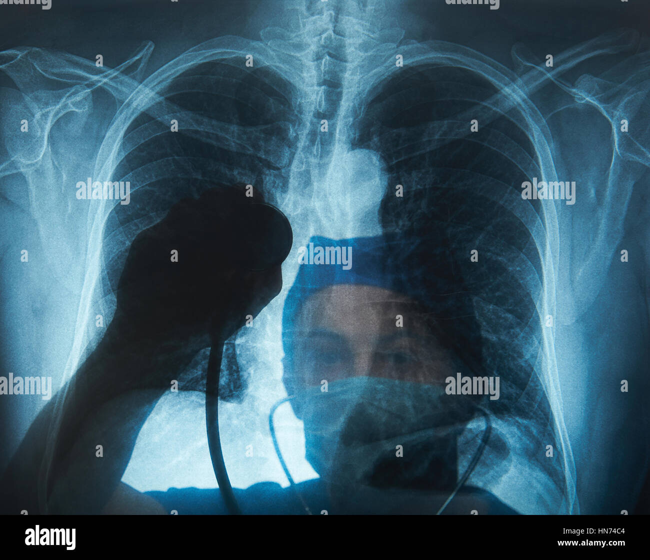 Chest x ray doctor checking hi-res stock photography and images - Alamy