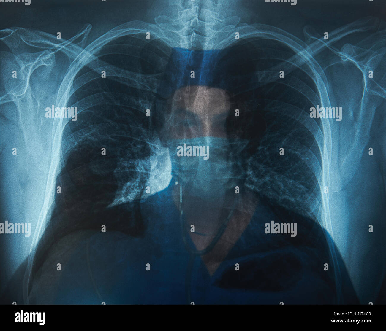 x-ray image of human lungs with doctor on back Stock Photo - Alamy