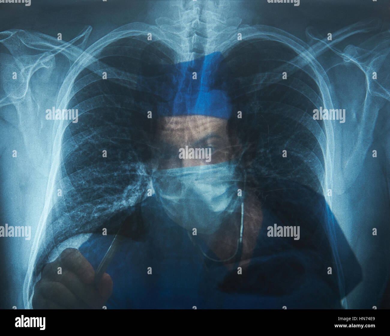 Chest x ray nurse hi-res stock photography and images - Alamy
