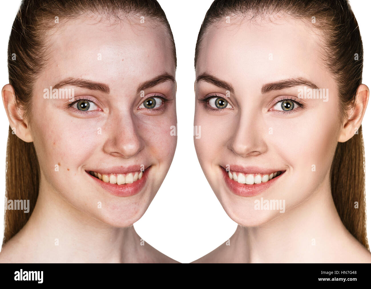 Aging face comparison hi-res stock photography and images - Alamy