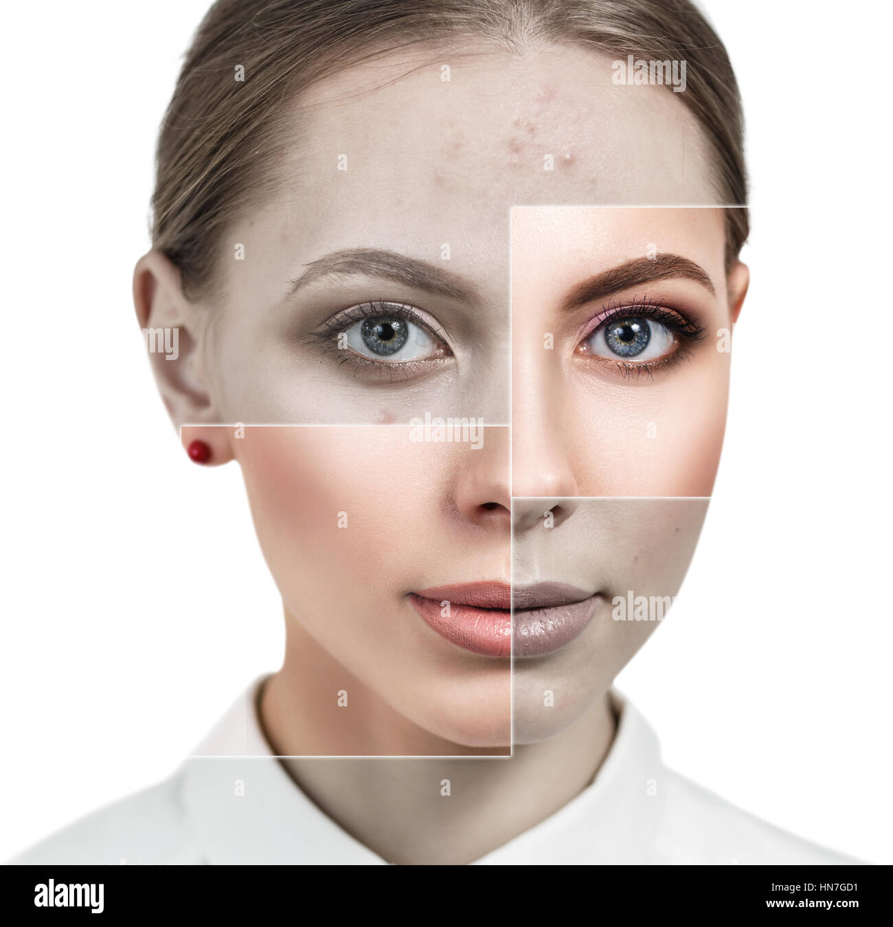 Square parts shows skin after treatment Stock Photo - Alamy