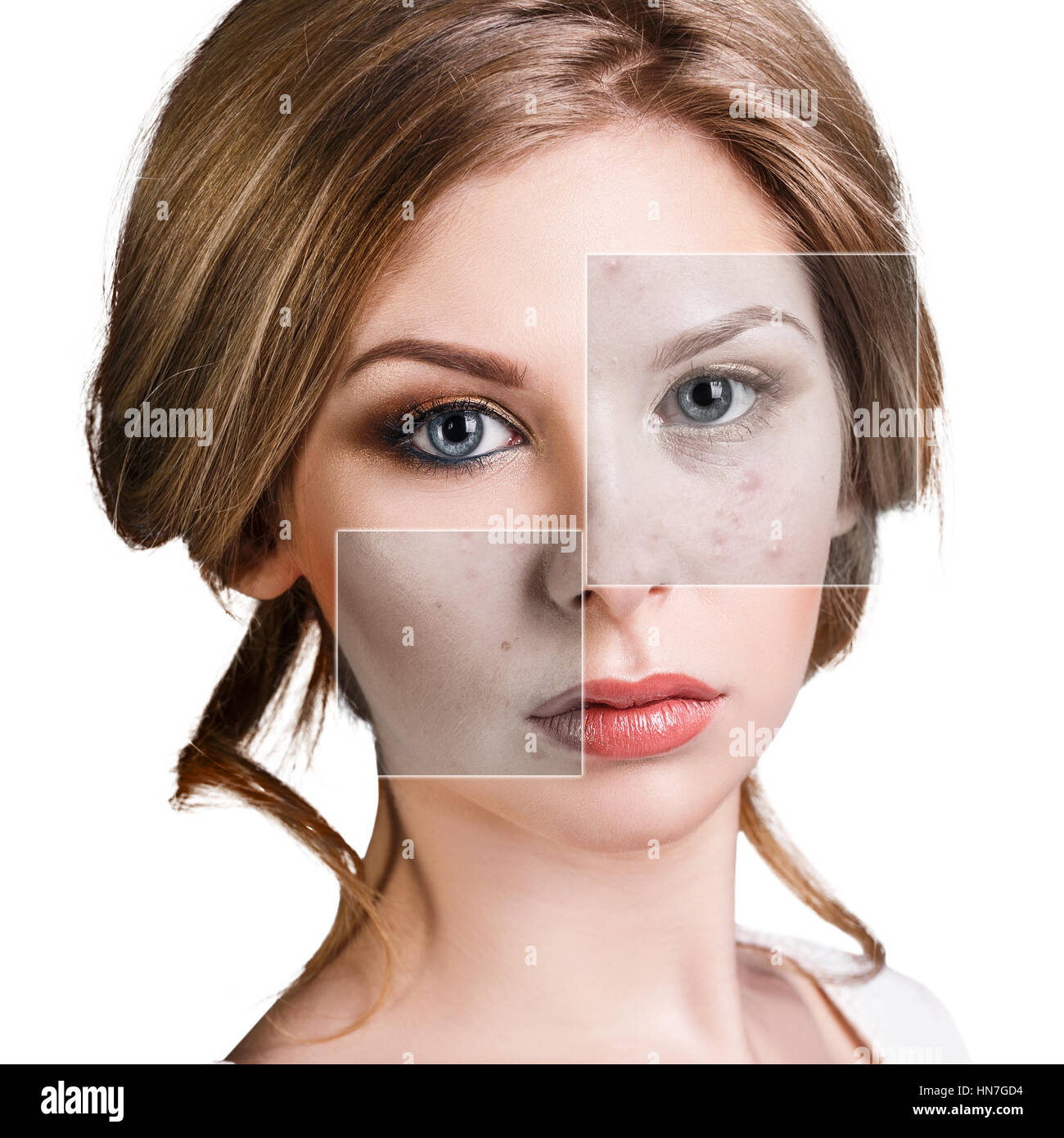 Square parts shows before skin problems Stock Photo - Alamy