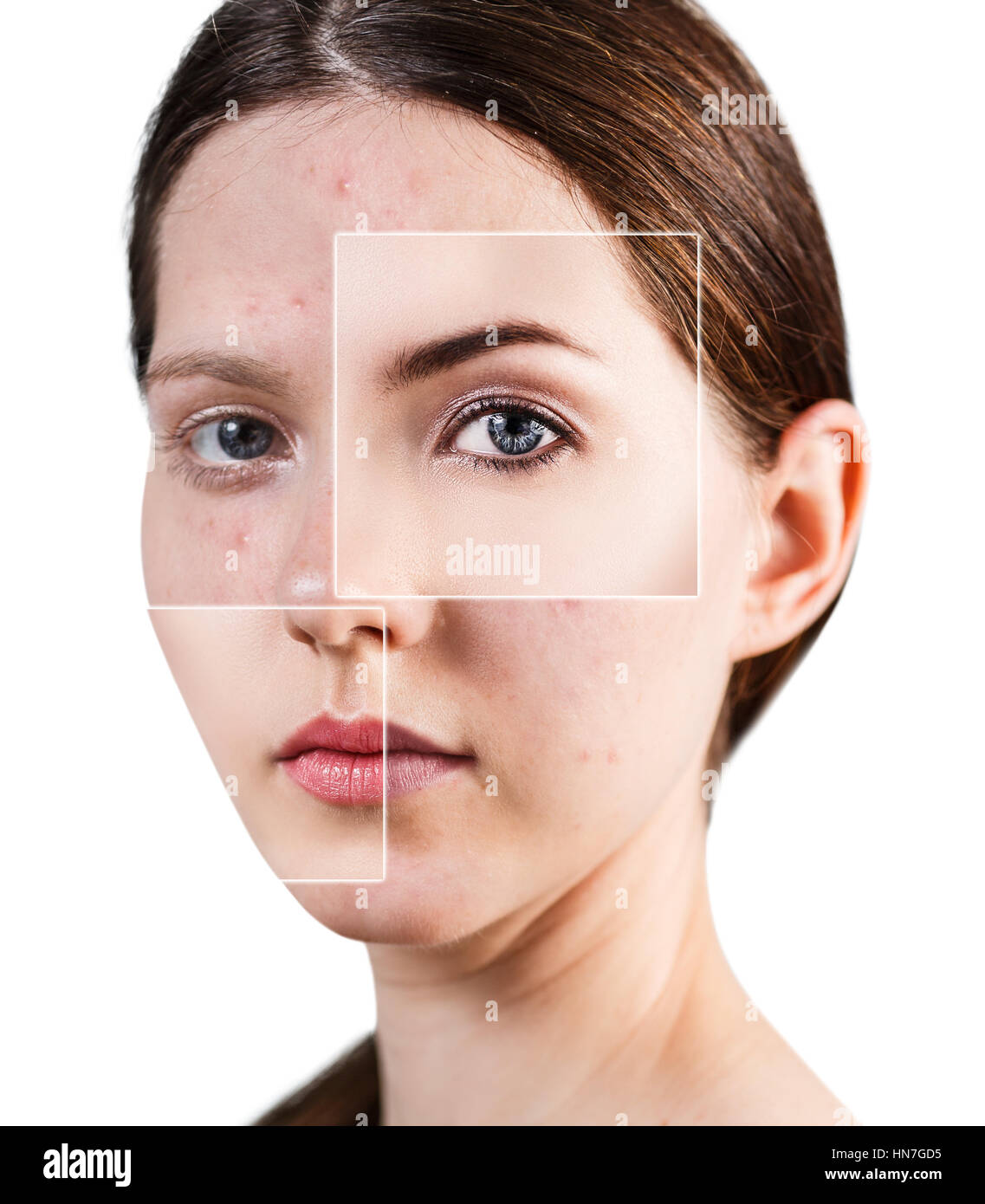 Square parts shows skin after treatment Stock Photo - Alamy
