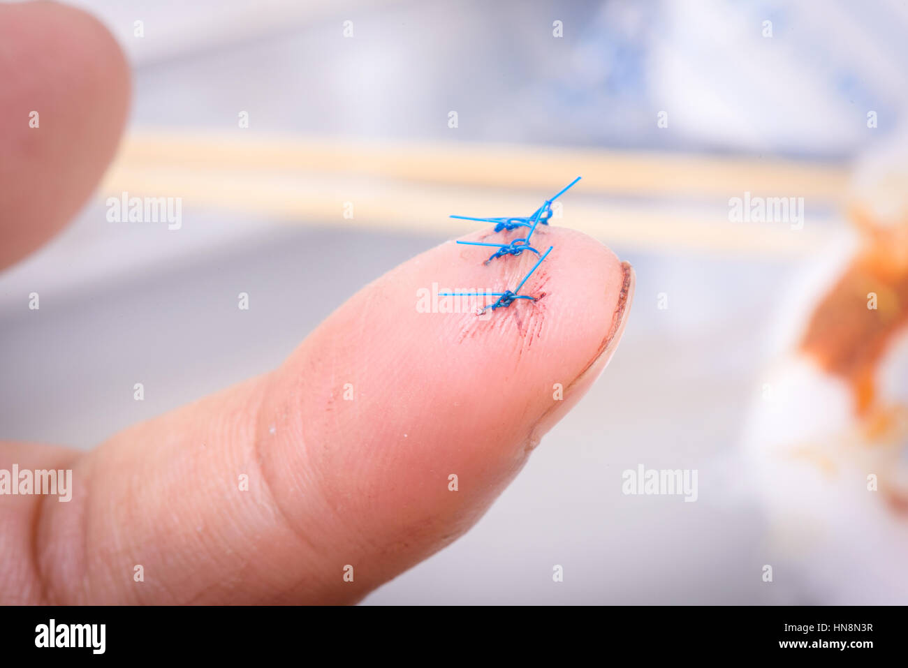 closeup wound with surgical stitch Stock Photo - Alamy