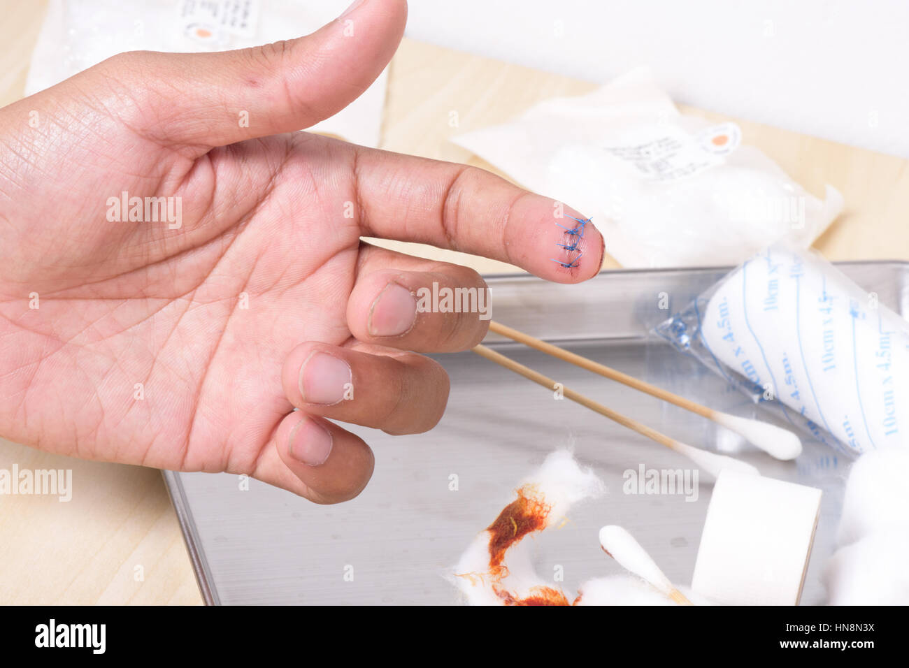 closeup wound with surgical stitch Stock Photo - Alamy