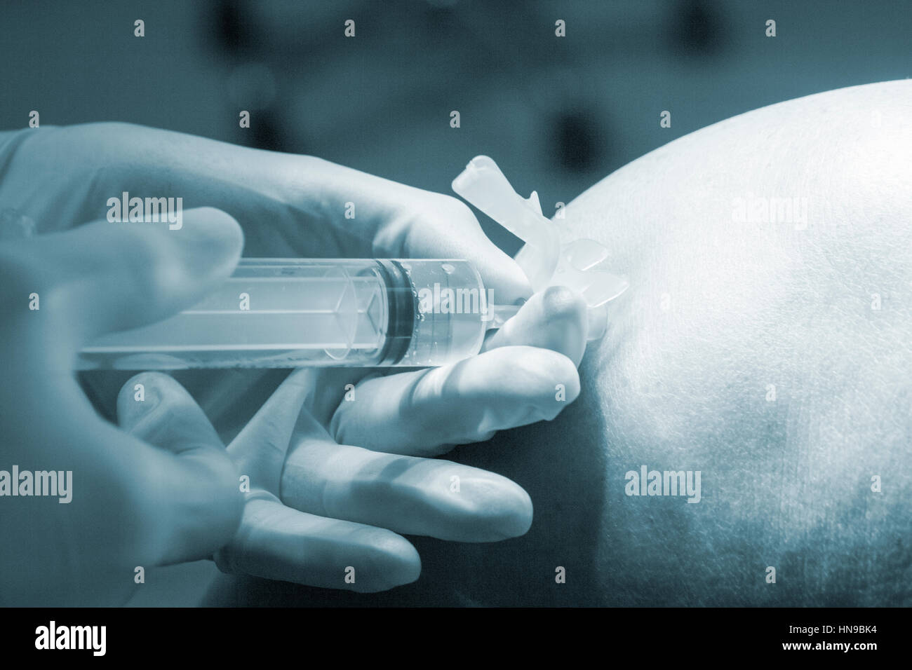 Anaesthetist anaestthetic injection for surgical operation knee ...