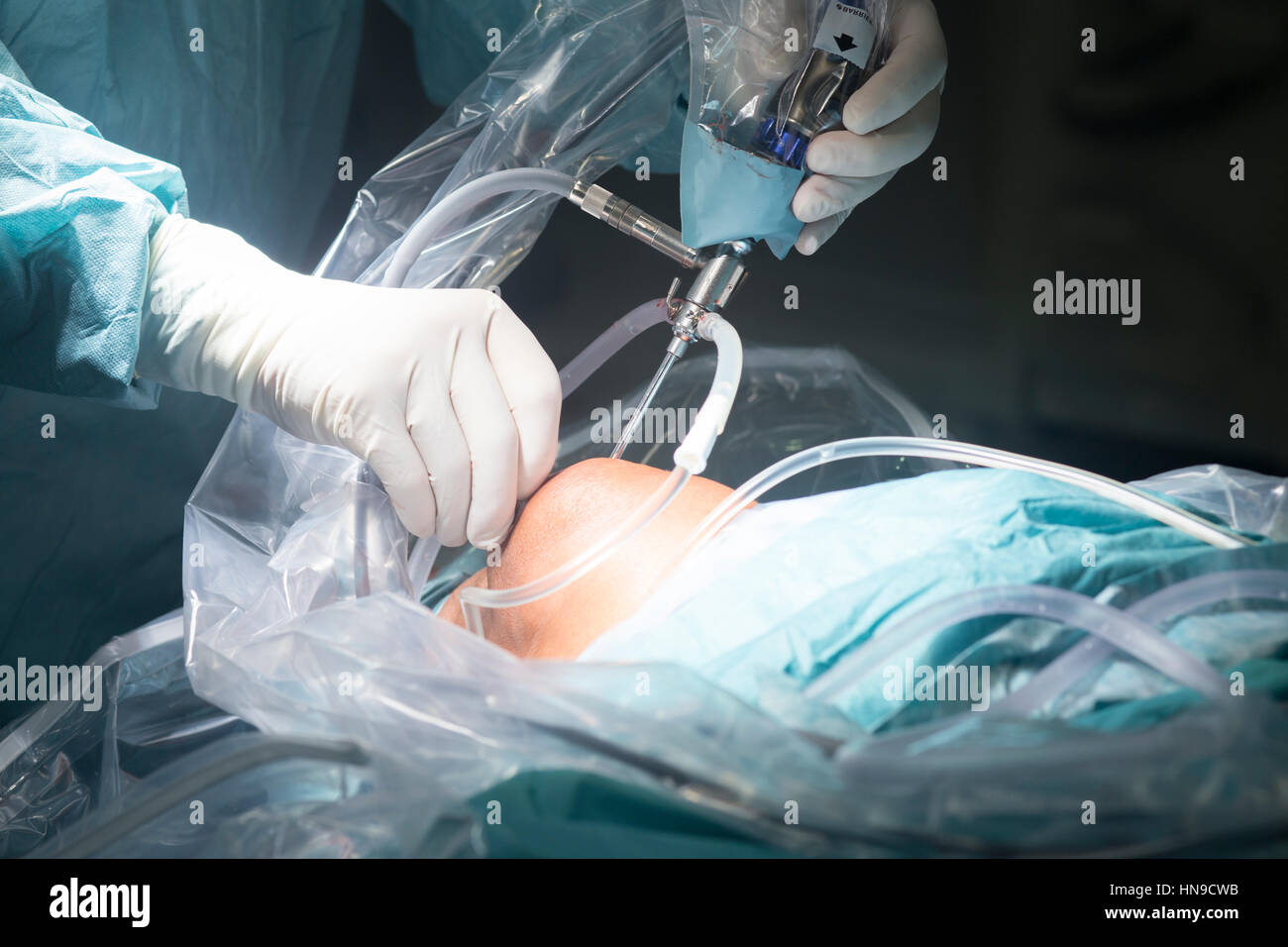 Knee keyhole surgery hospital arthroscopy operation medical procedure ...