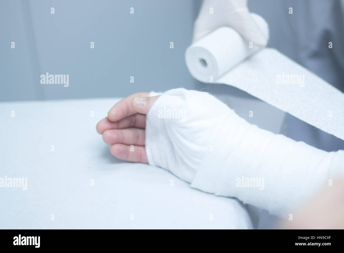 Doctor applying a plaster cast and bandages to patient forearm and ...