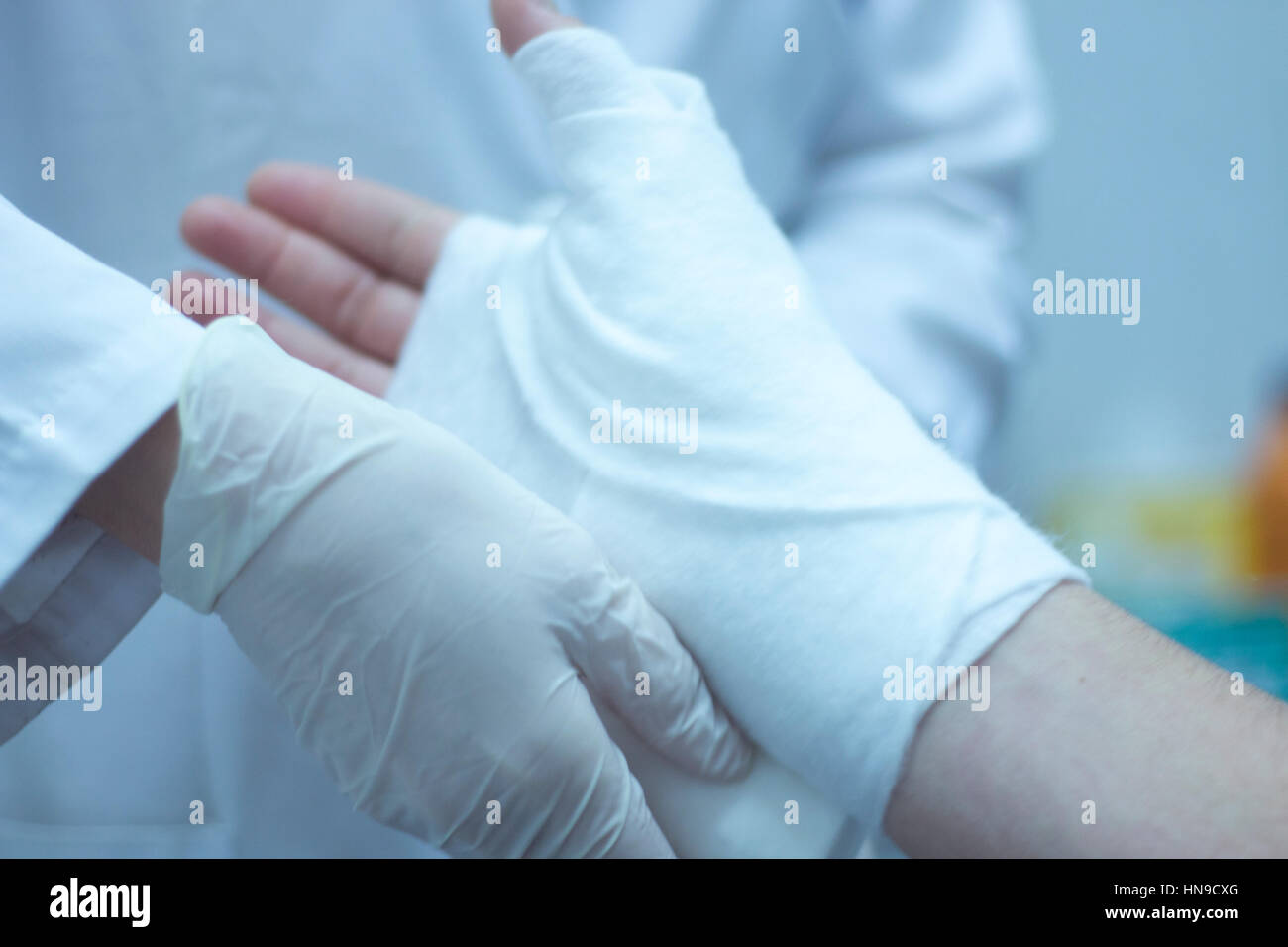 Doctor applying a plaster cast and bandages to patient forearm and ...