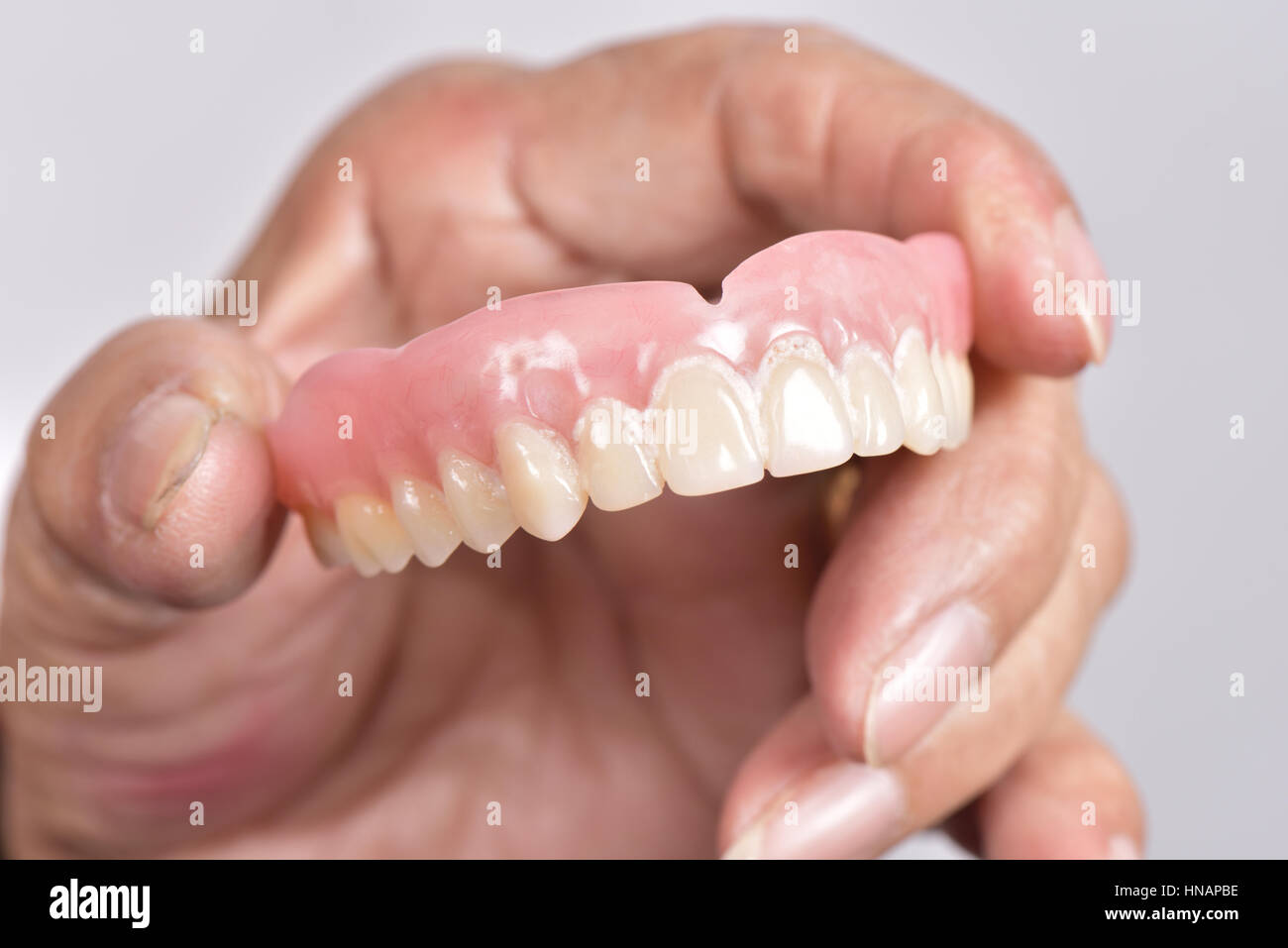 False tooth hi-res stock photography and images - Alamy