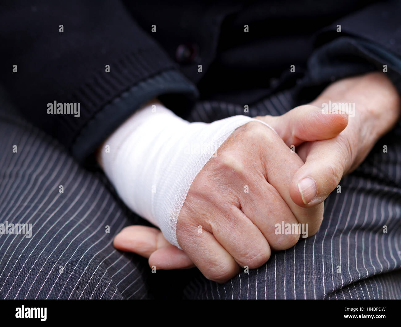 Close up of wrinkled sprained wrist Stock Photo - Alamy