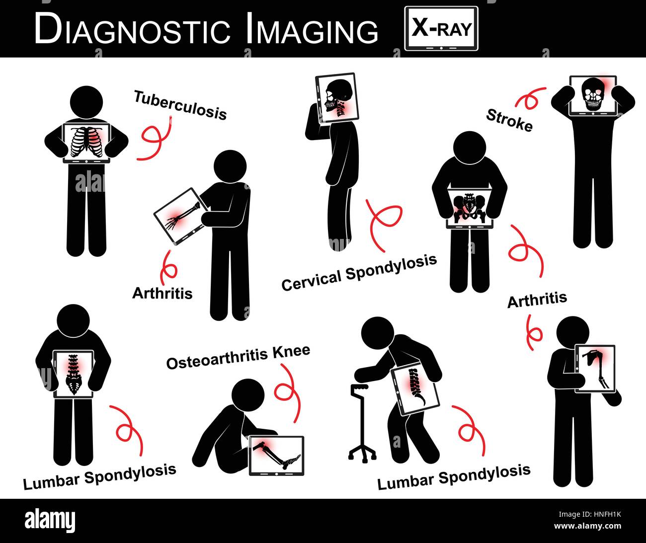 Diagnostic Imaging & Multiple Disease stick man vector ( Pulmonary ...