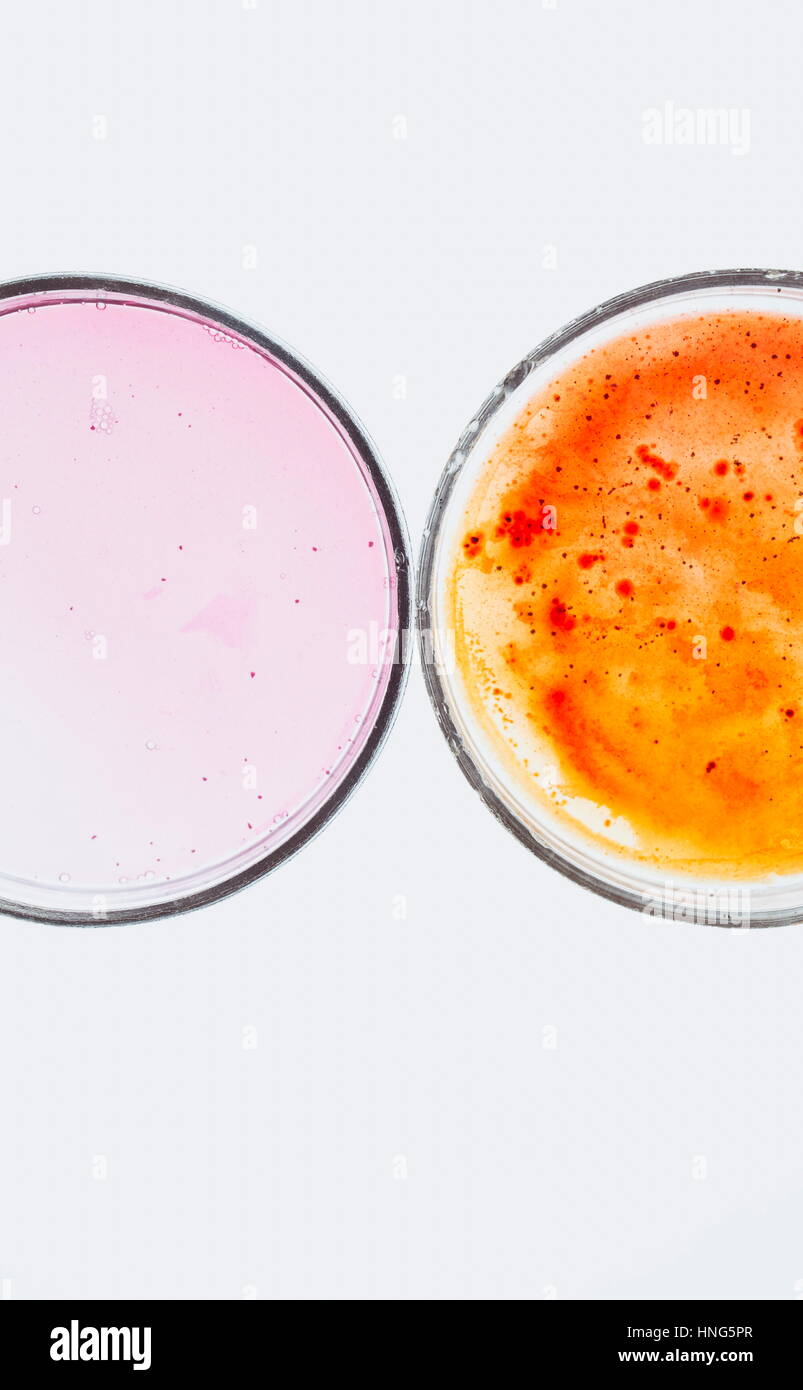 Bacterial Infection Test at Michelle Peckham blog