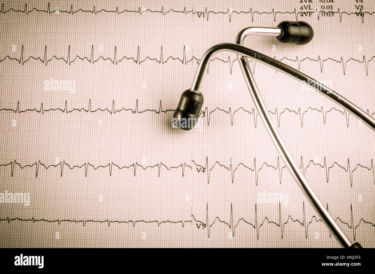 Electrocardiogram examination hi-res stock photography and images - Alamy