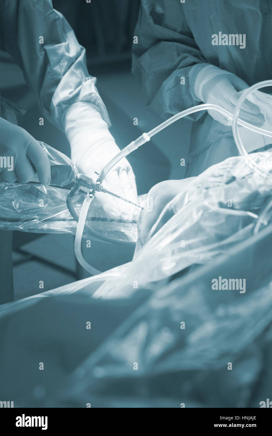 Knee keyhole surgery hospital arthroscopy operation medical procedure ...