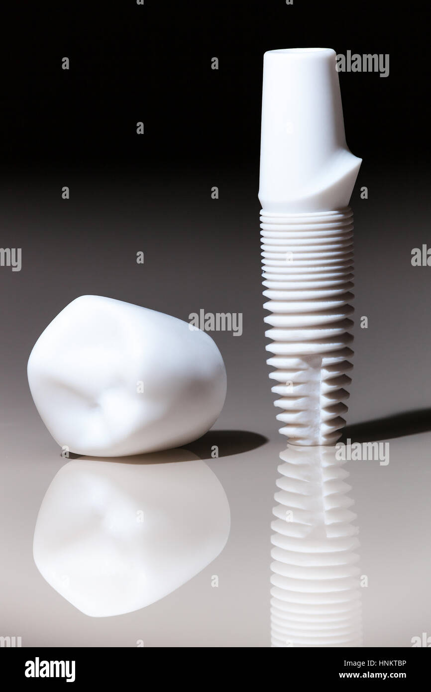 Dental implant dentist, tooth, medicine, artificial tooth, tooth layout ...