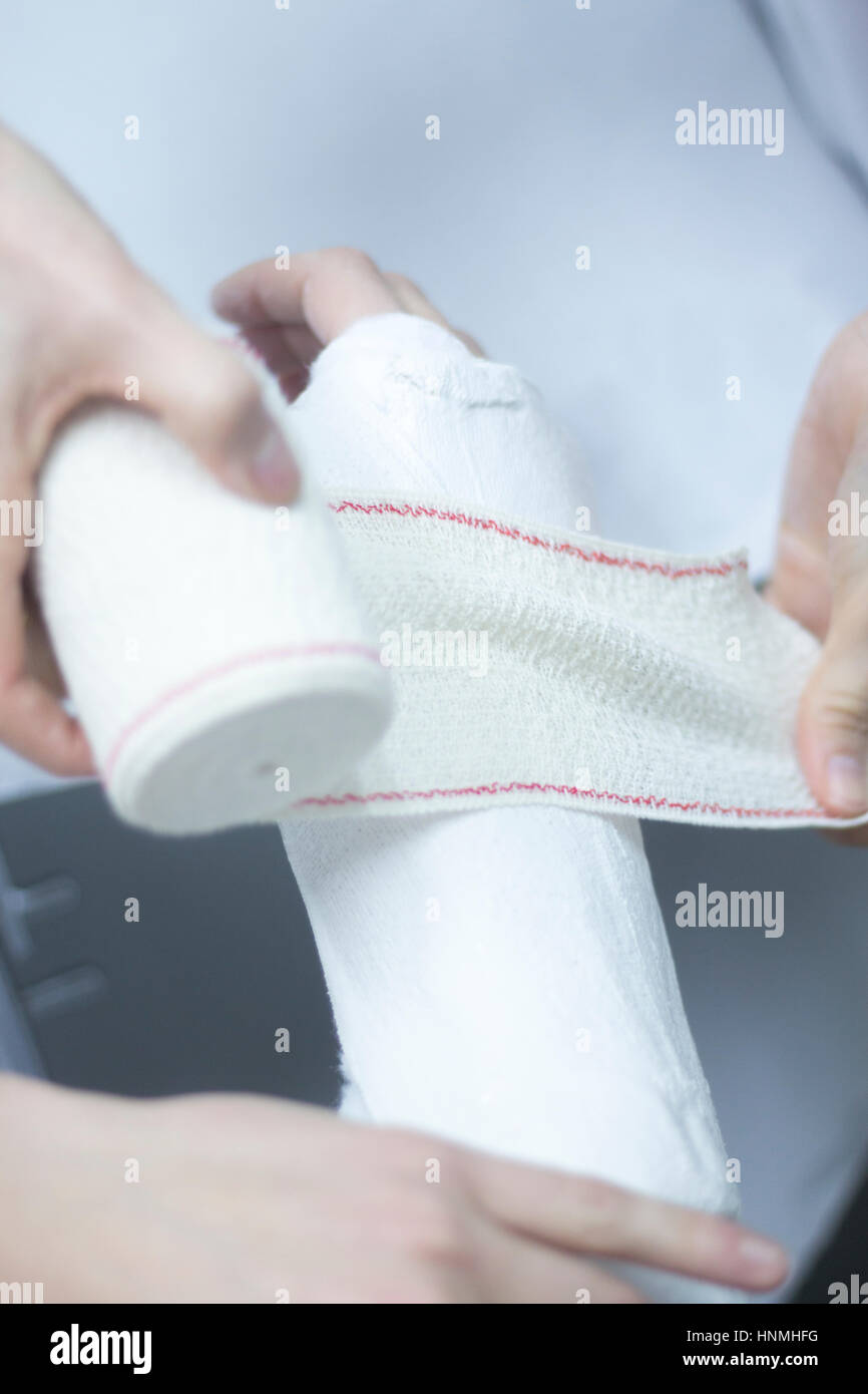 Doctor applying a plaster cast and bandages to patient forearm and ...