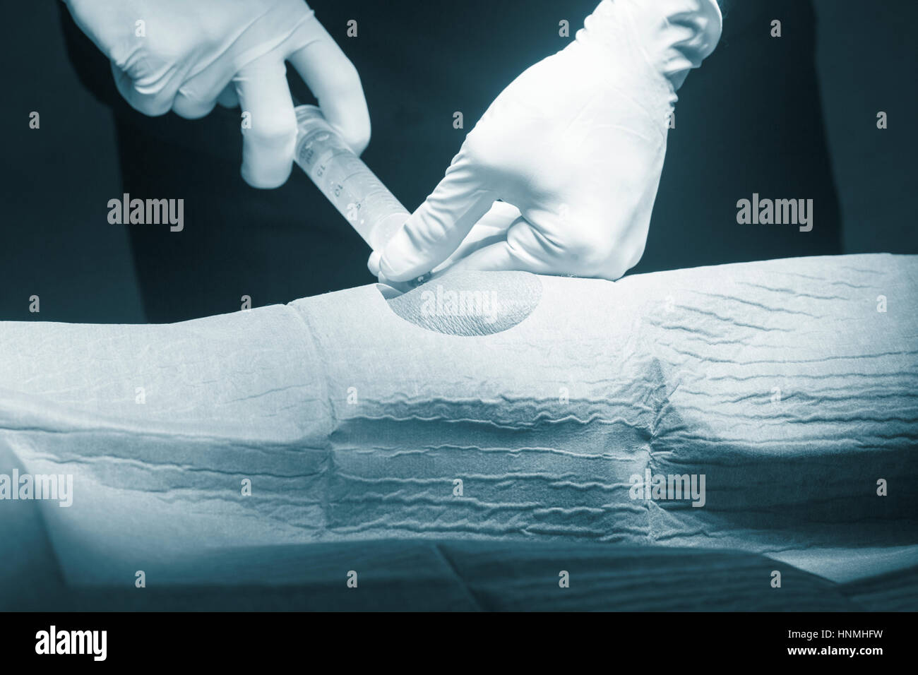 Anaesthtist anaesthetic injection in knee for surgery hospital ...