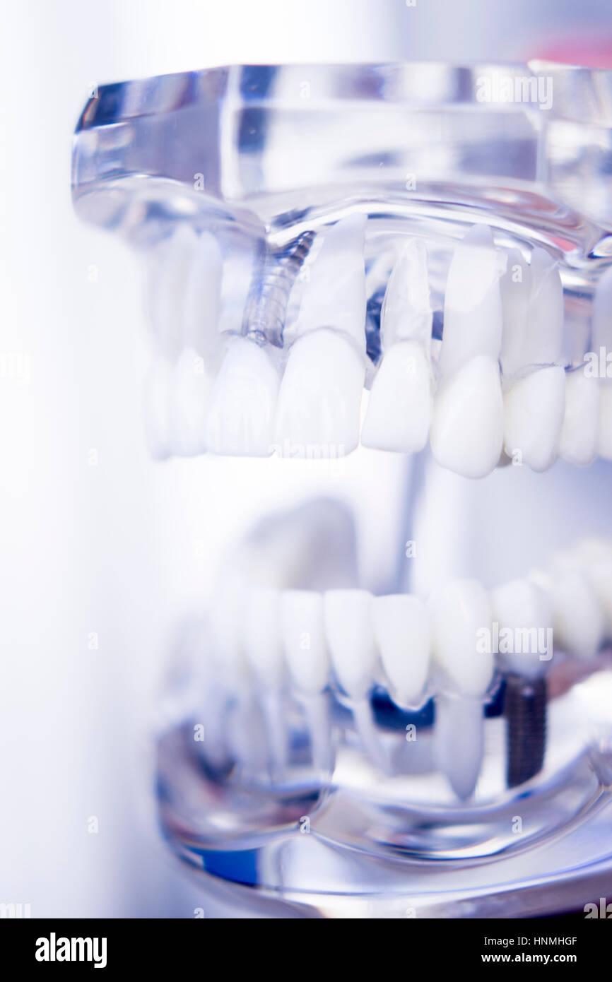 Dentists tooth plastic model used for teaching, learning and patient ...