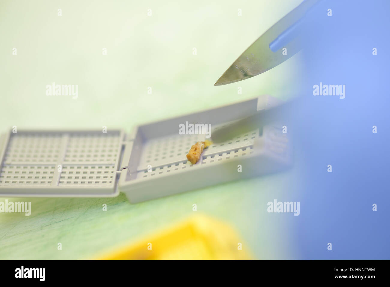 Closeup of medical sample and scalpel Stock Photo - Alamy