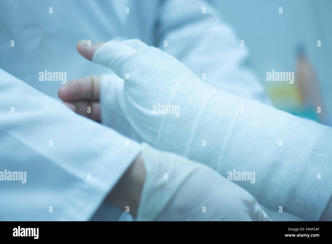 Doctor applying a plaster cast and bandages to patient forearm and ...