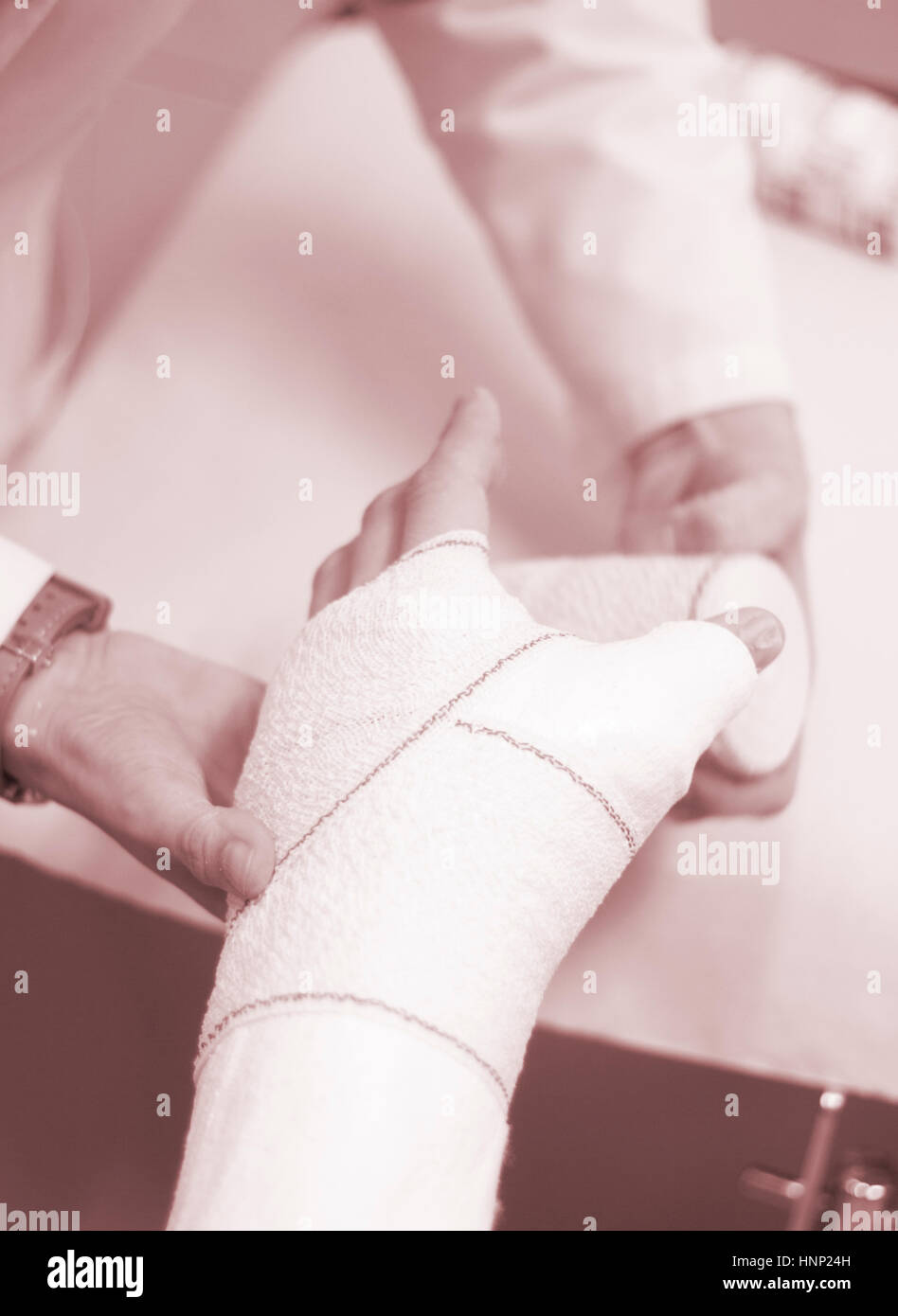 Doctor applying a plaster cast and bandages to patient forearm and ...