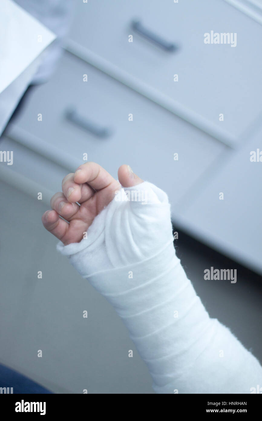 Doctor applying a plaster cast and bandages to patient forearm and ...