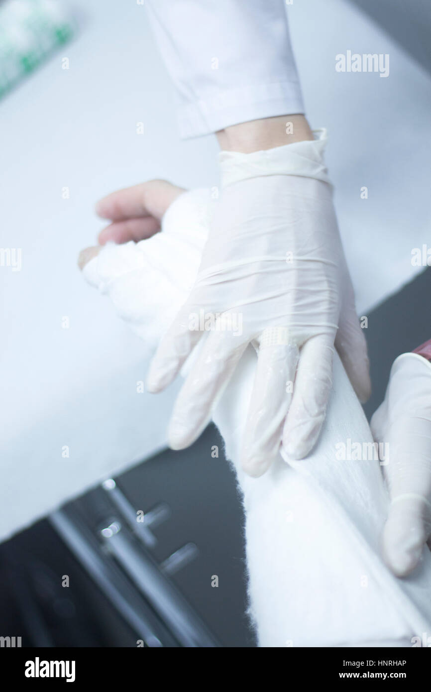 Doctor applying a plaster cast and bandages to patient forearm and ...
