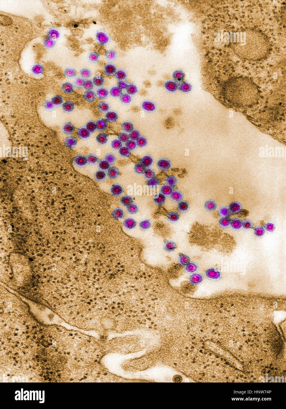 Full frame microscopic image of rubella virus virions budding from the ...