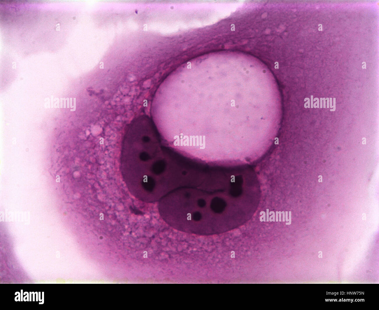 Epithelial Cells Under Microscope
