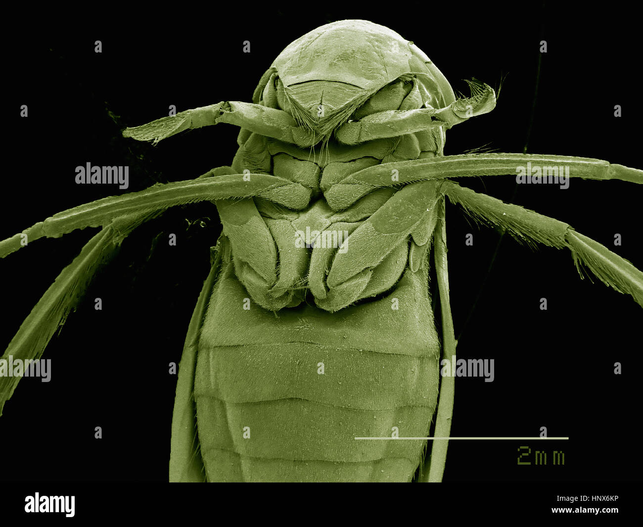 Scanning electron micrograph of the head of a female backswimmer ...