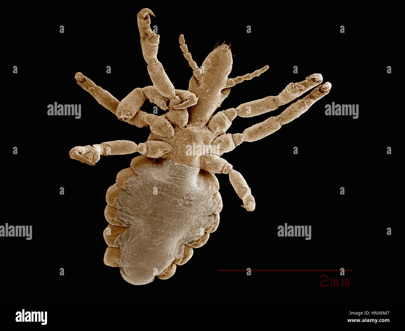 Scanning electron micrograph of a hog louse (Phthiraptera ...